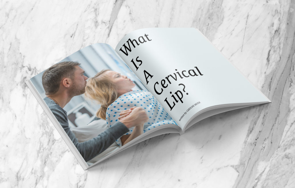 Overview of a Cervical Lip in Labor – Women's Integrative Health