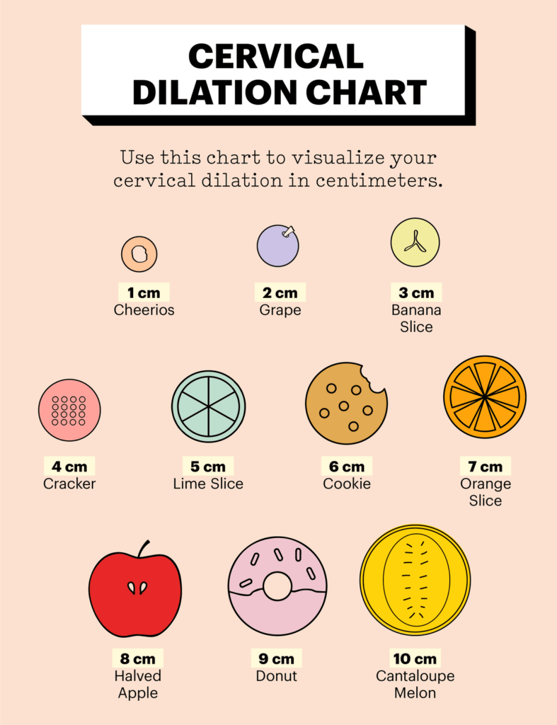 Cervical Dilation Chart – What to Expect During Each of the Stages of ...