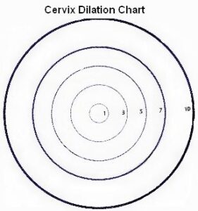 Cervical Dilation Chart – What to Expect During Each of the Stages of ...